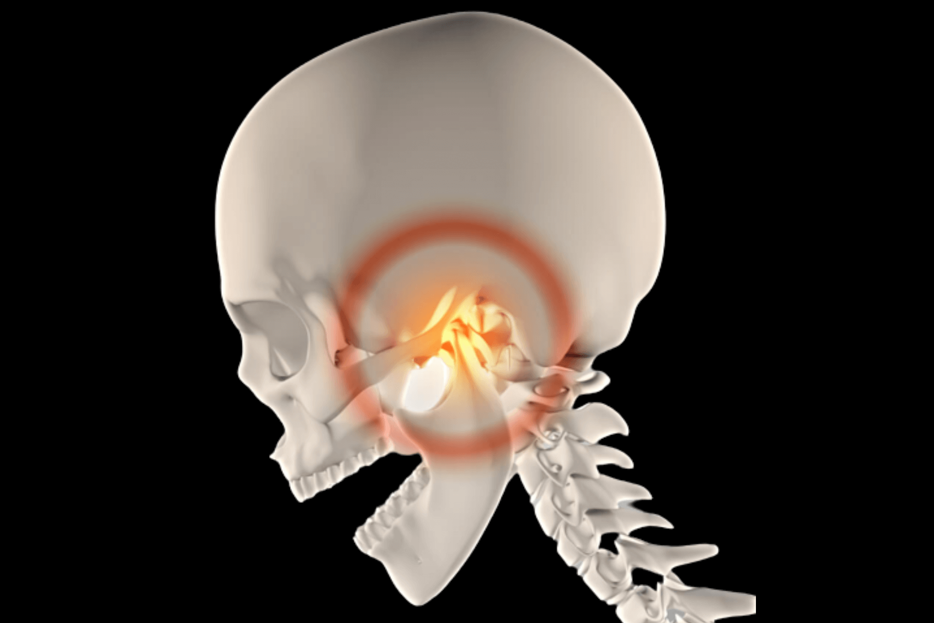 TMJ Disorder: It's Painful? How To Treat-Symptoms and Cause - QPIOR