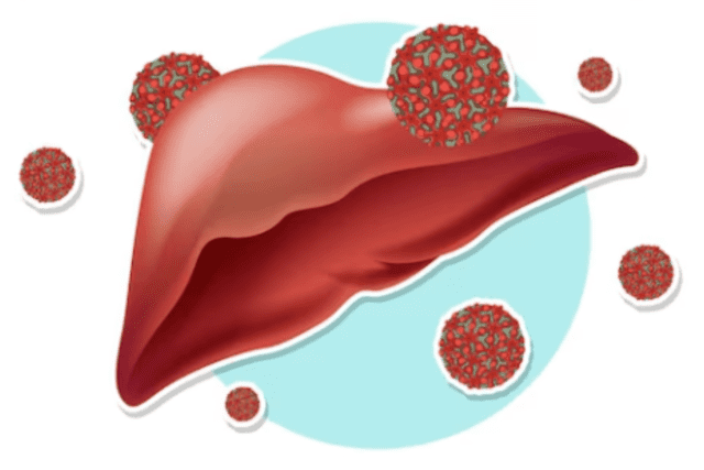 Hepatitis: Symptoms, Causes and Treatment - QPIOR